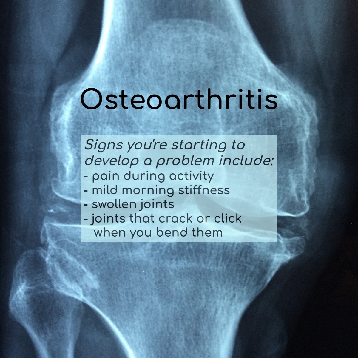 5 signs of OSTEOARTHRITIS - Spine & Sports Physical Therapy and Massage ...